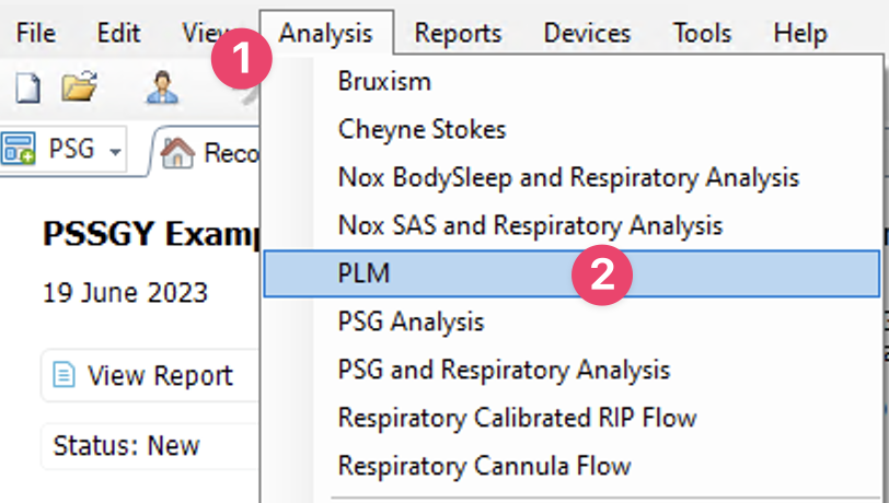 Scoring Limb Movements and Periodic Limb Movements in Noxturnal – Nox ...