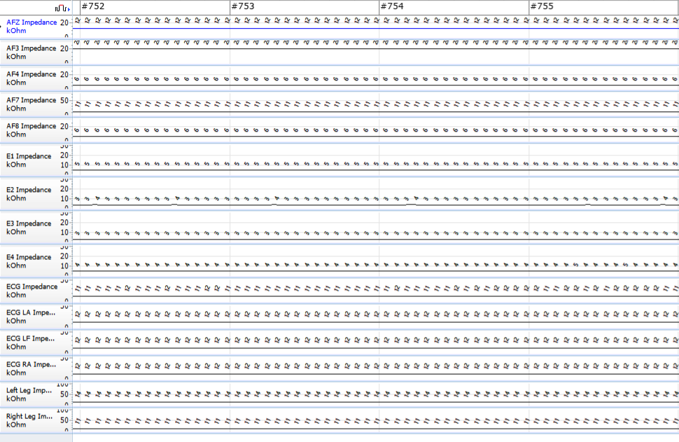 Nox SAS Signals and Impedance Measurements – Nox Support