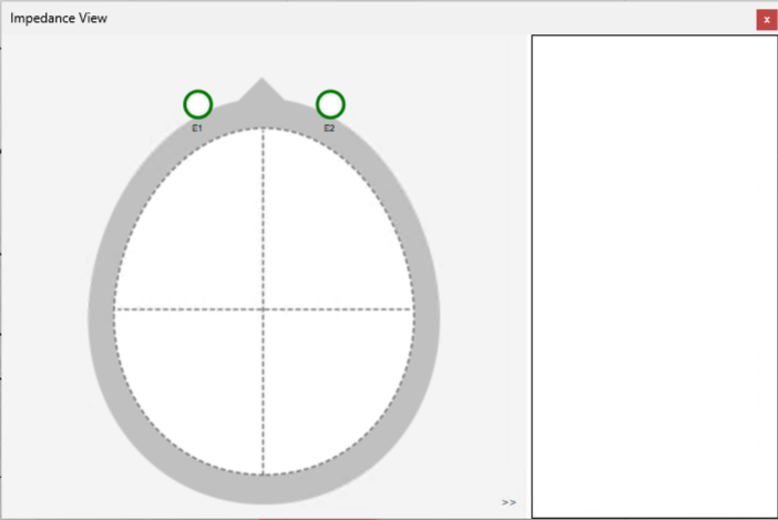 Nox SAS Signals and Impedance Measurements – Nox Support