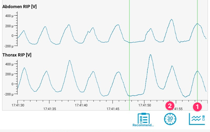Performing Bio-calibrations with Noxturnal and Noxturnal App – Nox Support