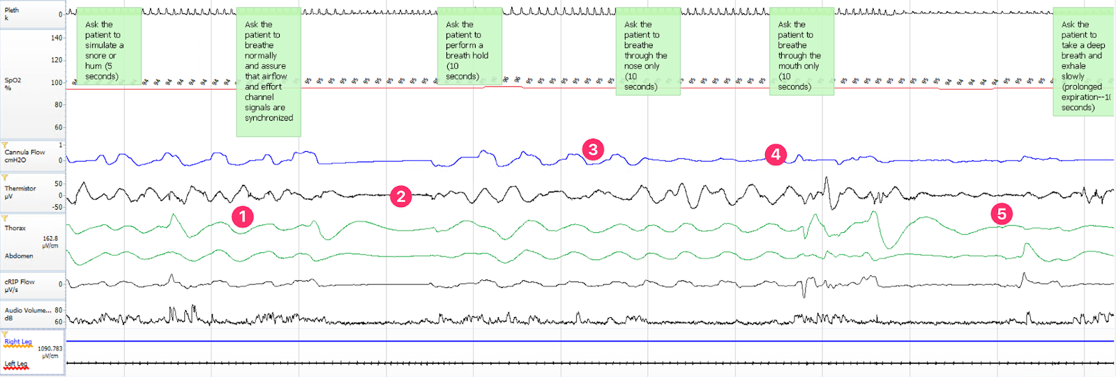 Performing Bio-calibrations with Noxturnal and Noxturnal App – Nox Support