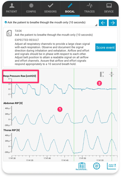 Performing Bio-calibrations with Noxturnal and Noxturnal App – Nox Support
