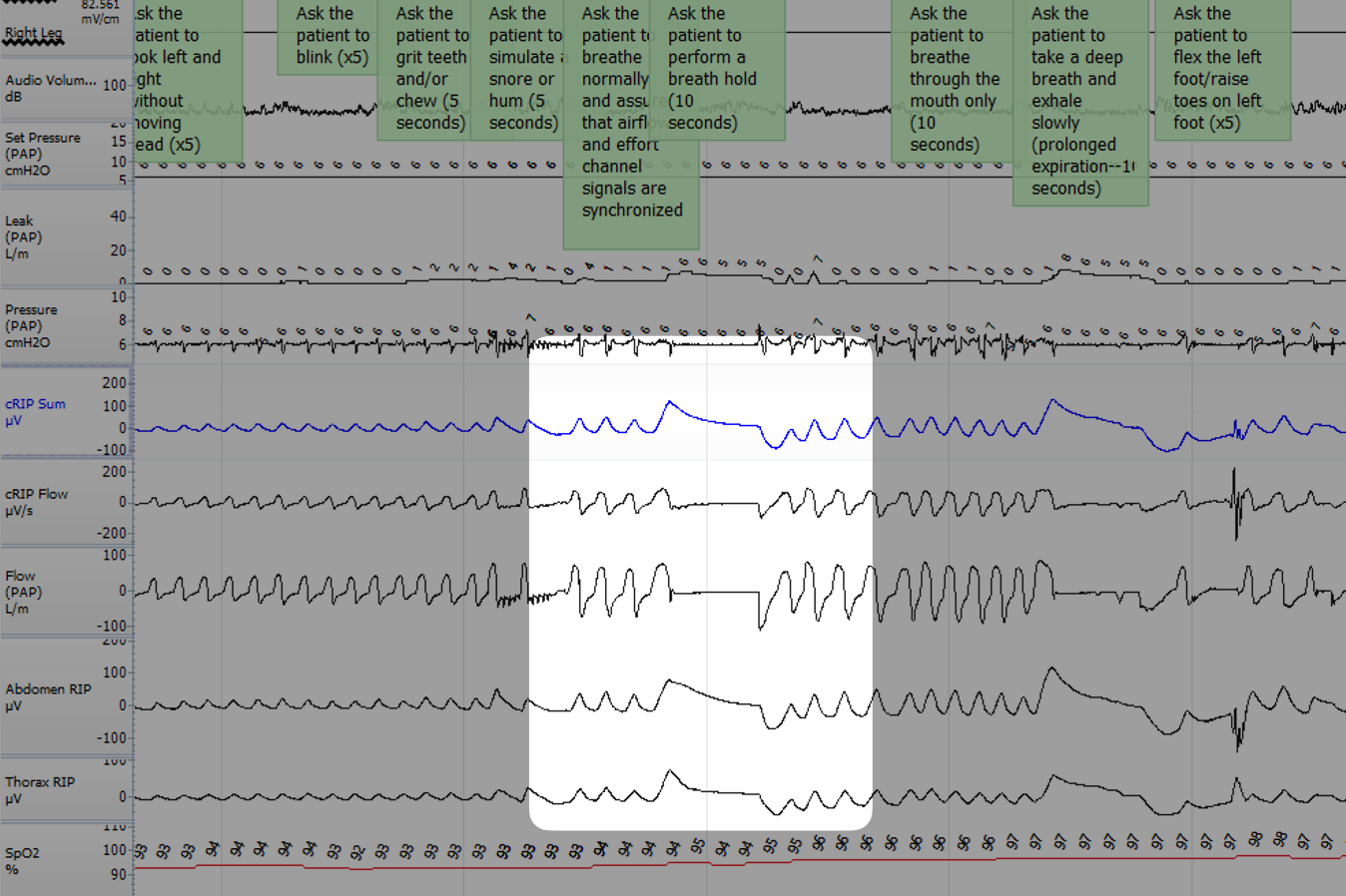 Performing Bio-calibrations with Noxturnal and Noxturnal App – Nox Support