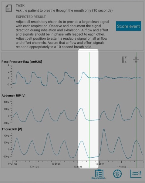 Performing Bio-calibrations with Noxturnal and Noxturnal App – Nox Support