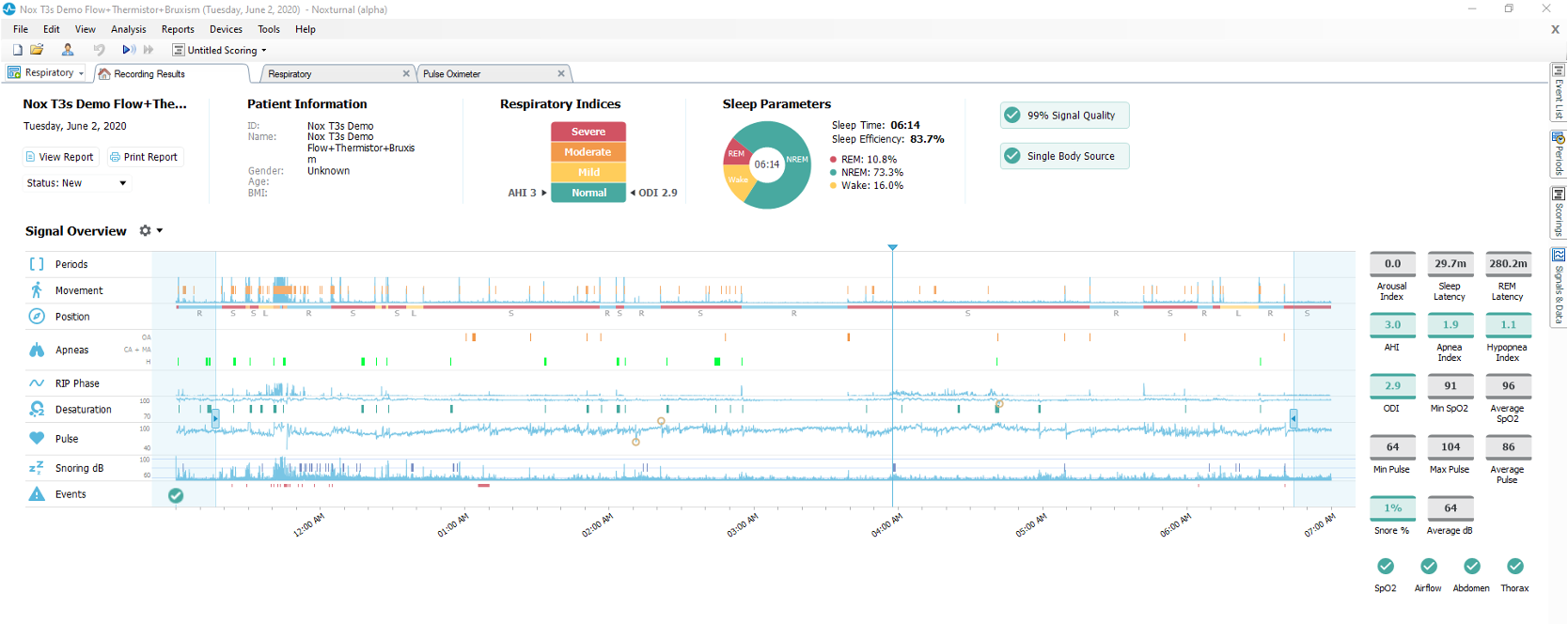 Nox T3 and T3s Setup Guide (Noxturnal 6) – Nox Support